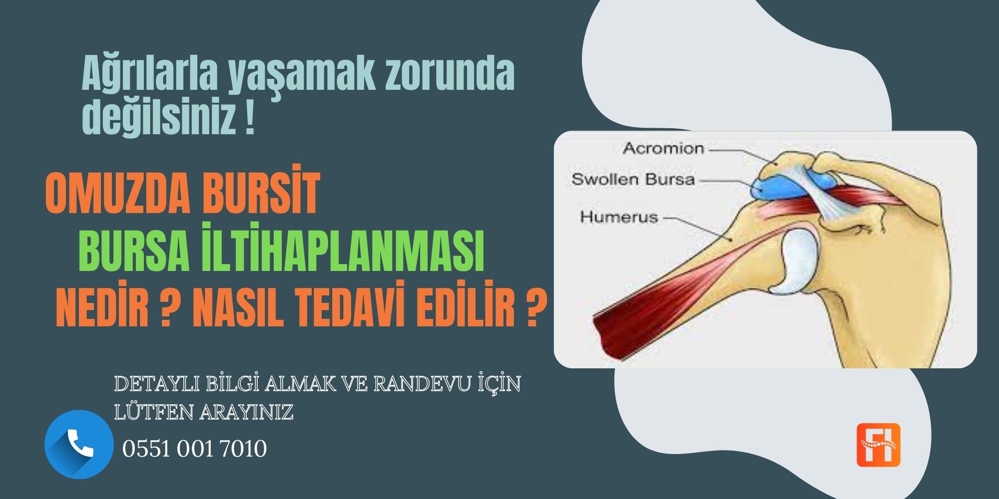 Omuz Bursiti (Omuz Bursa İltihaplanması) - Fizyoterapist Ali İsik